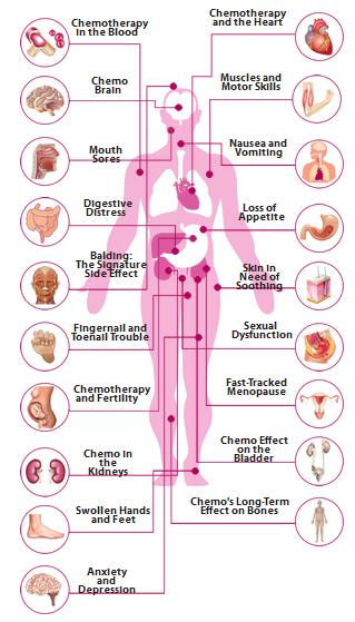 The Side Effects of Chemotherapy on the Body.