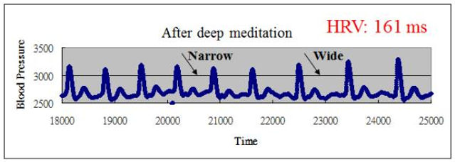 HRV & ANS | Taiwanscientific