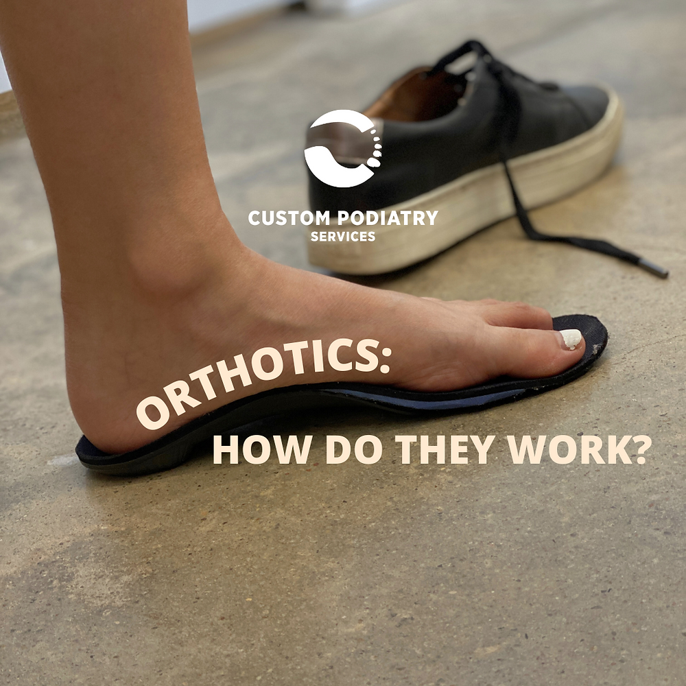 Understanding Orthotics: How They Work to Support Your Feet Understanding Orthotics: How They Work to Support Your Feet