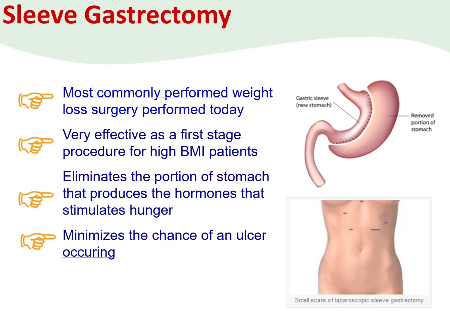 Bariatric And Metabolic Surgery Singapore Arden Jr Surgery