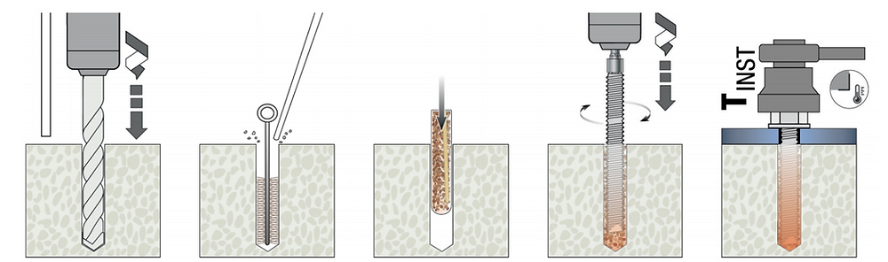 ChemSet vs TruBolts in Steel Structures