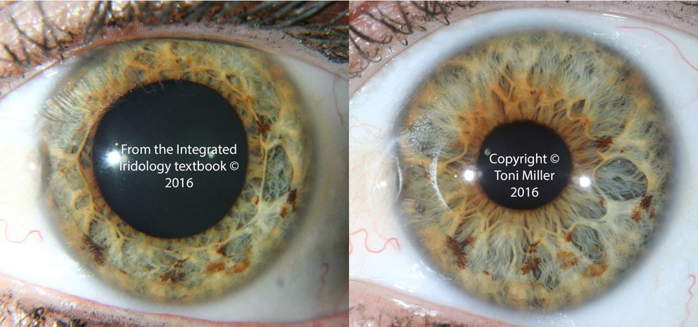 Does the iris change? Part 3