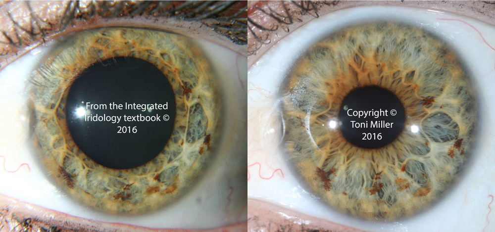 Does the iris change? Part 3