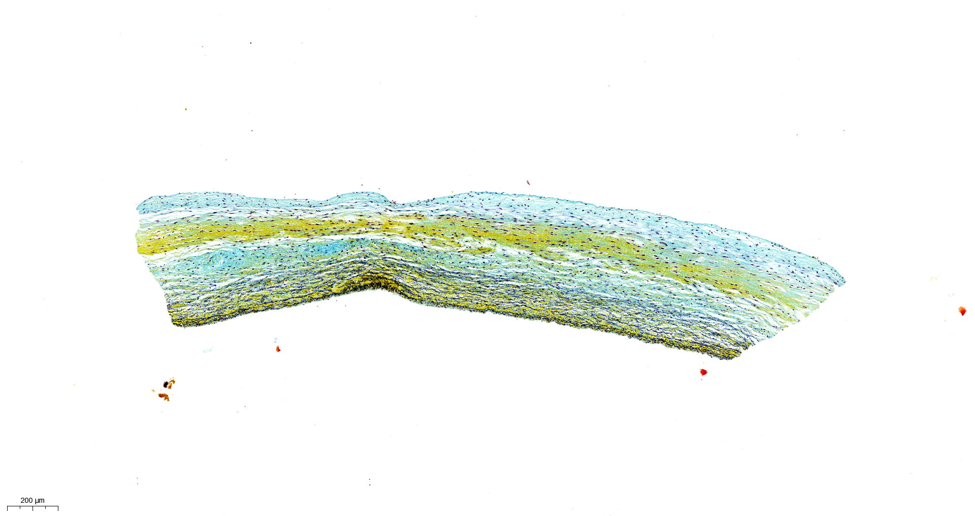 Movat Pentachrome stain