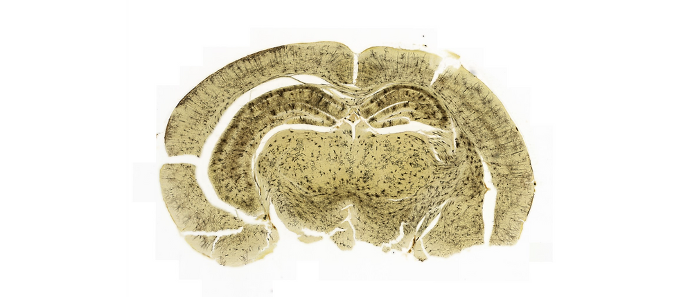 What Is Histopathology? A Complete Guide for Researchers and Clinicians