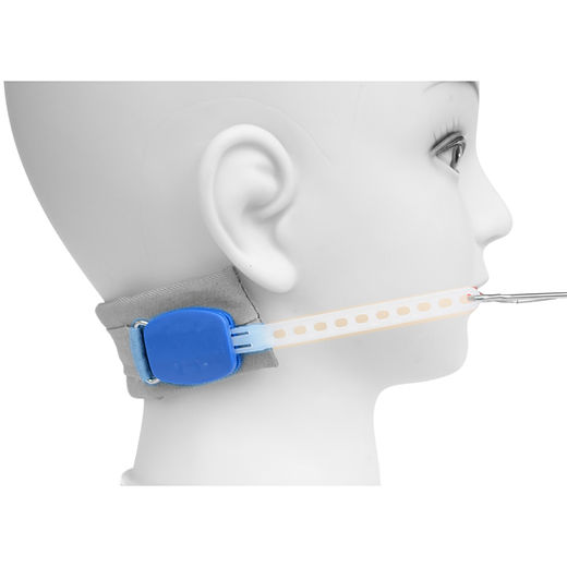 underbite correction headgear