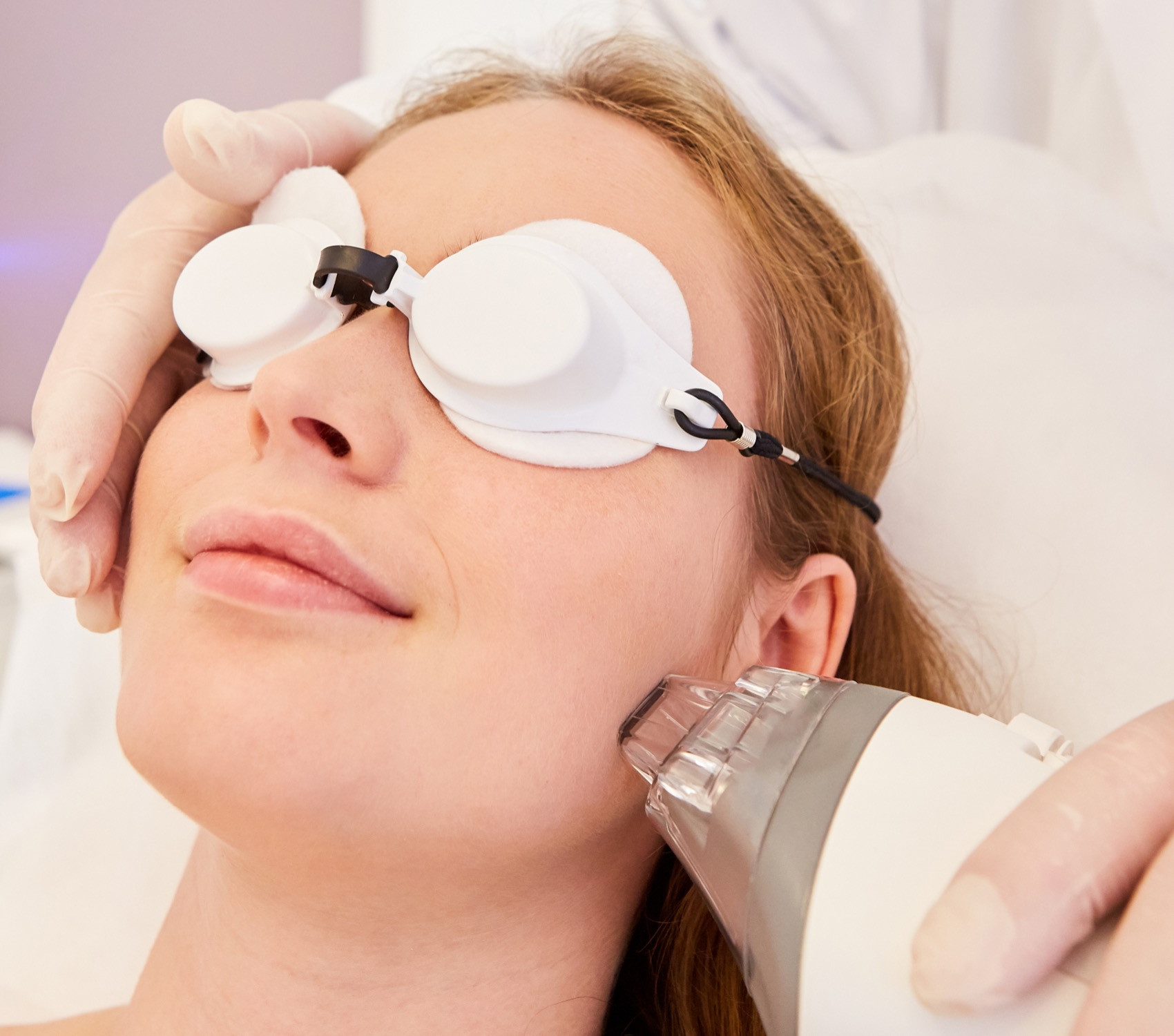 Erbium Glass Deep Dermal Renewal | Permanent Beauty Aesthetics