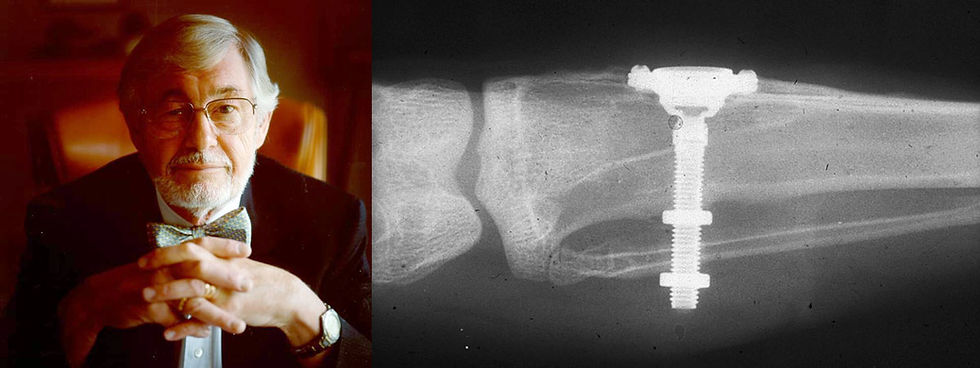 Metal Misconceptions: Separating Fact from Fiction in Dental Implant Safety