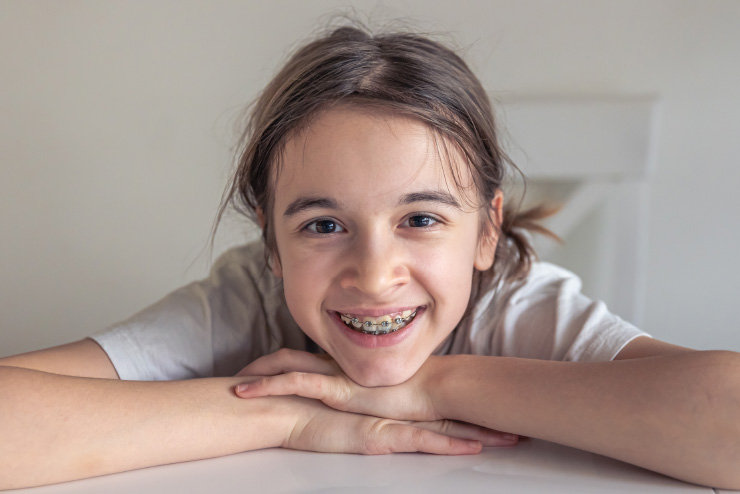 Heads up on headgear