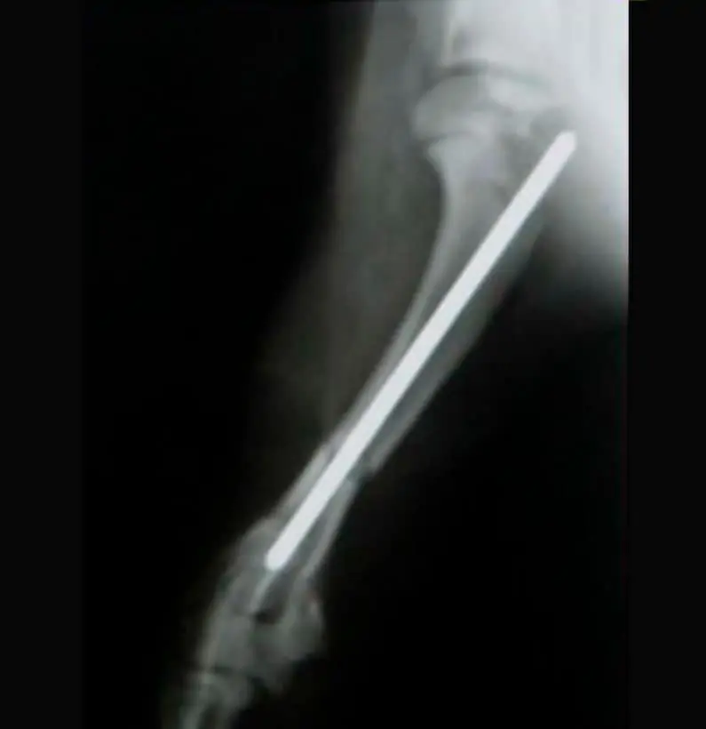 Clavos Steinmann | FullPet