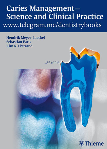 Caries Management - Science and Clinical Practice | DcX BookStore