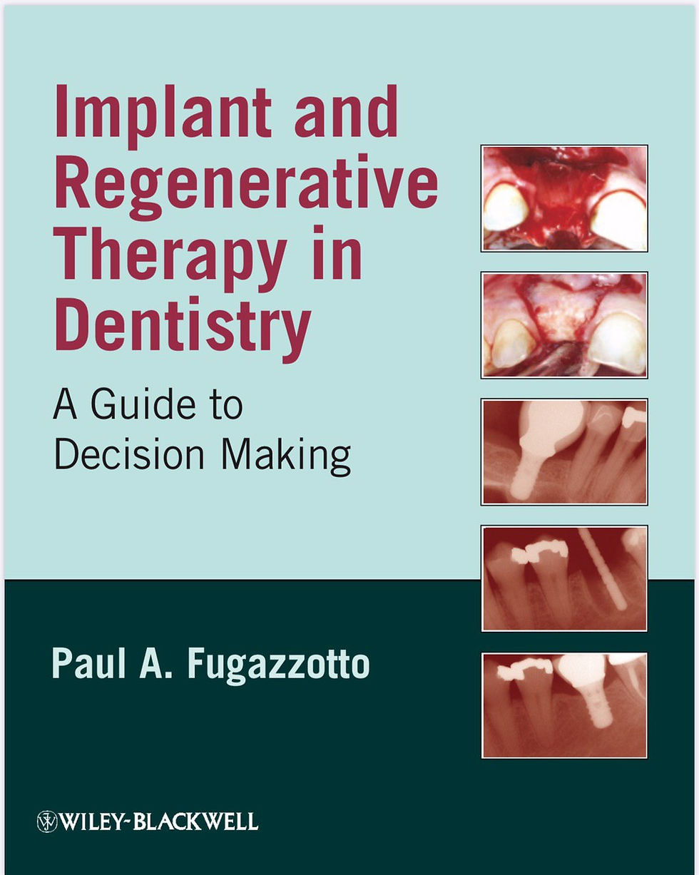 Implant and Regenerative Therapy in Dentistry : A Guide to Decision ...