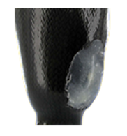 Proximal Lock | Coyote Prosthetics