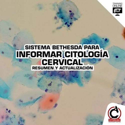 Minicurso sistema Bethesda para Informar Citología Cervical | Citorushtc