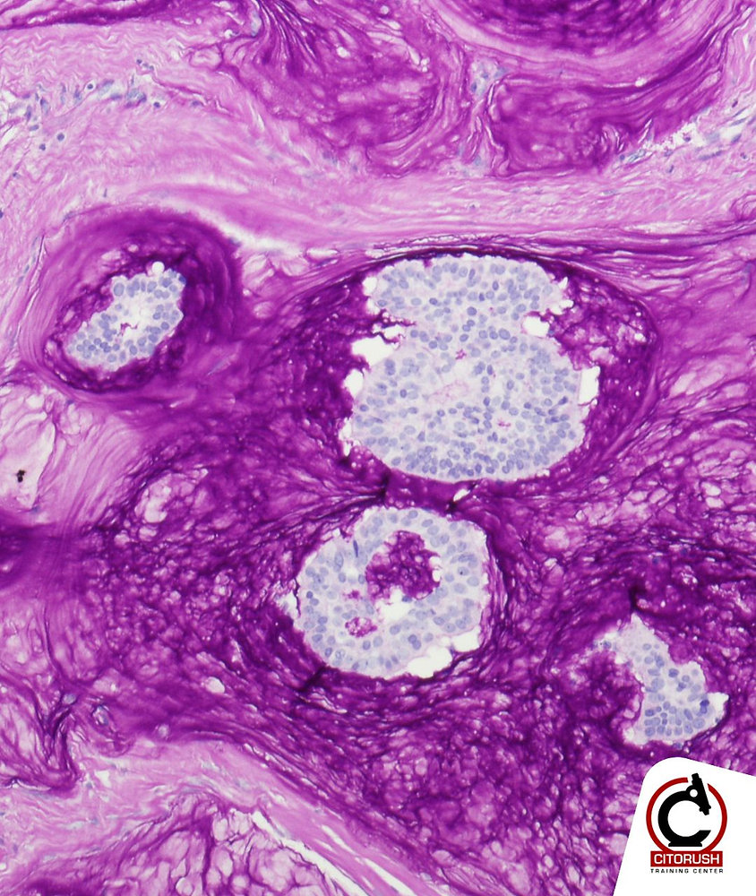 Protocolo de Tinción PAS para Tejidos: Una Guía Completa