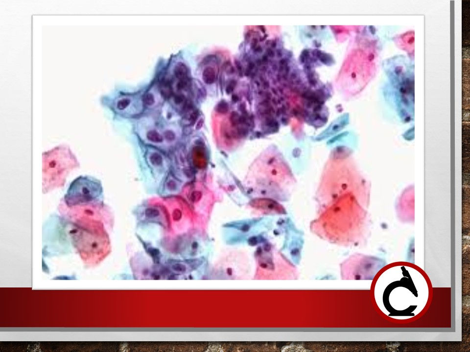 Pruebas de diagnóstico de VPH