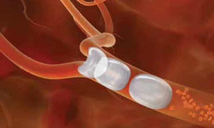 MICROSPHERE HEPASPHERE | IMA, S.A.