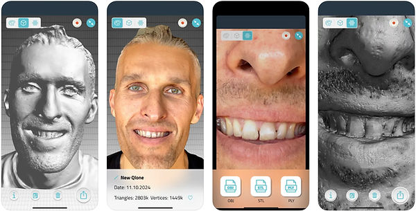 Qlone Dental Pro | Bellus3D replacement