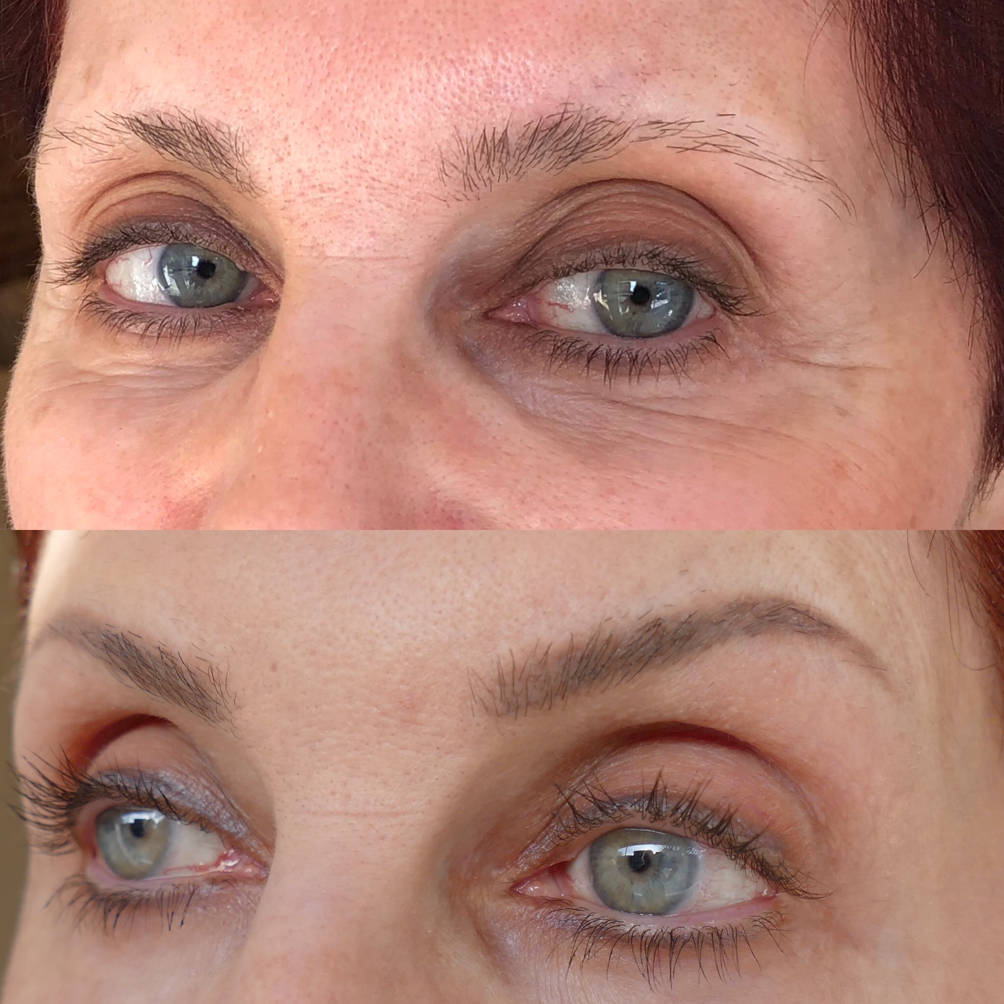 Brow Micropigmentation | Just Bare Skin