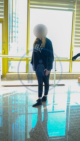 4.9cm Shortening Story | Height Reduction