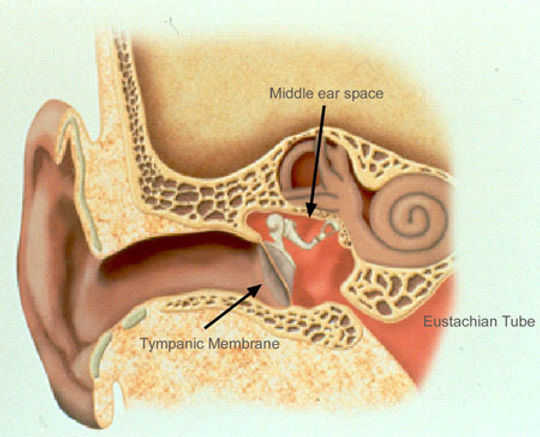 Can Chronic Ear Infections Cause Hearing Loss?