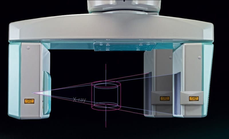 CBCT 101: 10 Fundamentals for Success