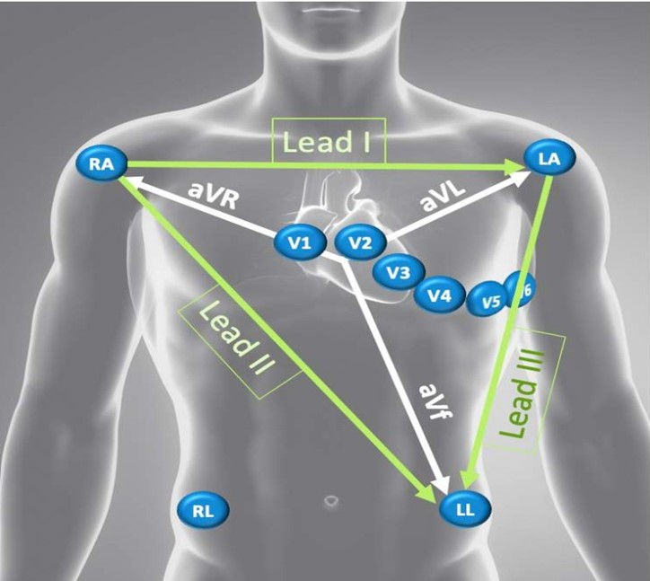 Identifying PVC Location: Can We Keep It Simple, Please?