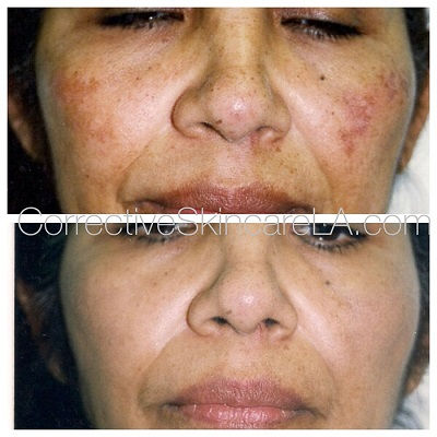 The Different Types of Skin Discoloration