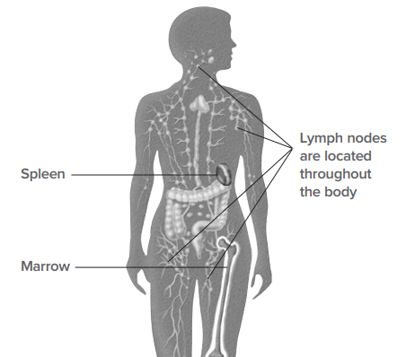 What is Lymphoma