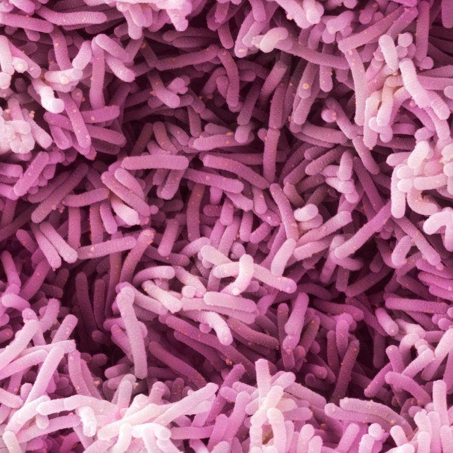 Lactobacillus casei | Biovital