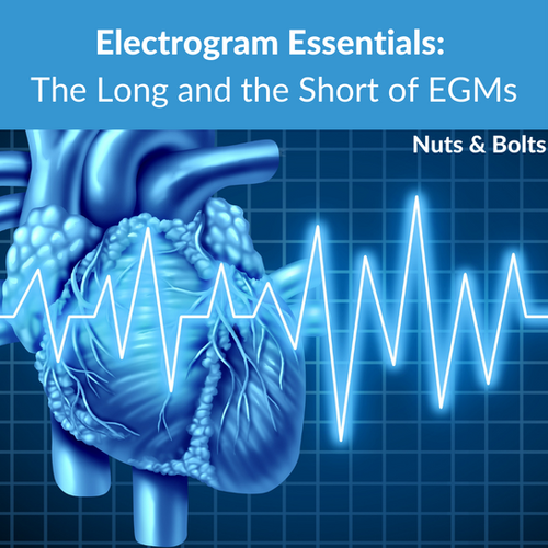 Electrogram Essentials: The Long and the Short of EGMs | CHA: EP Nerds ...