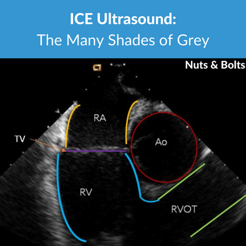 ICE Ultrasound: The Many Shades of Grey | CHA: EP Nerds Unite