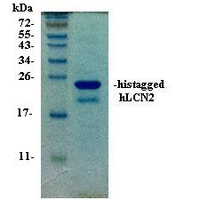 Lipocalin-2 (LCN2) protein | ImmunoDiagnostics