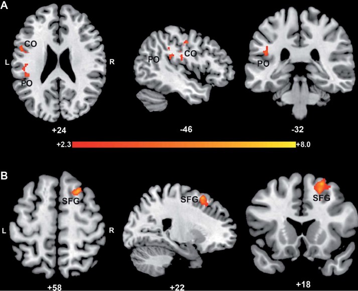 Scientists Find the Areas of the Brain Involved in Masochism