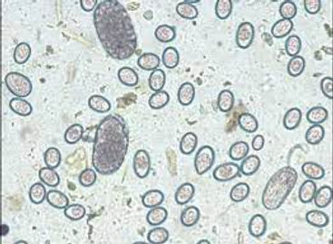 Mastering the Art of Deworming