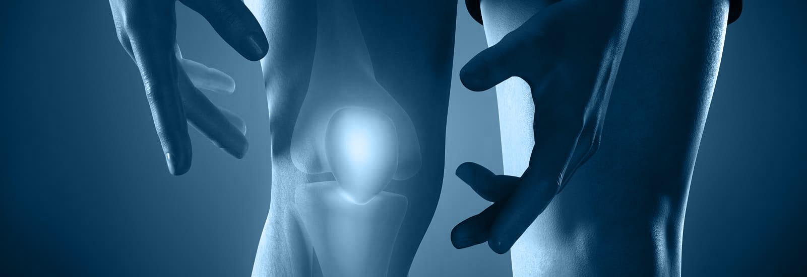 About the Knee | Arthritis & Sports Orthopaedics