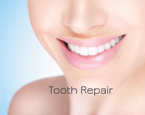 TOOTH REPAIR | Mane Body and Soul