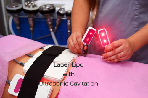 LASER LIPO AND CAVITATION | Mane Body and Soul