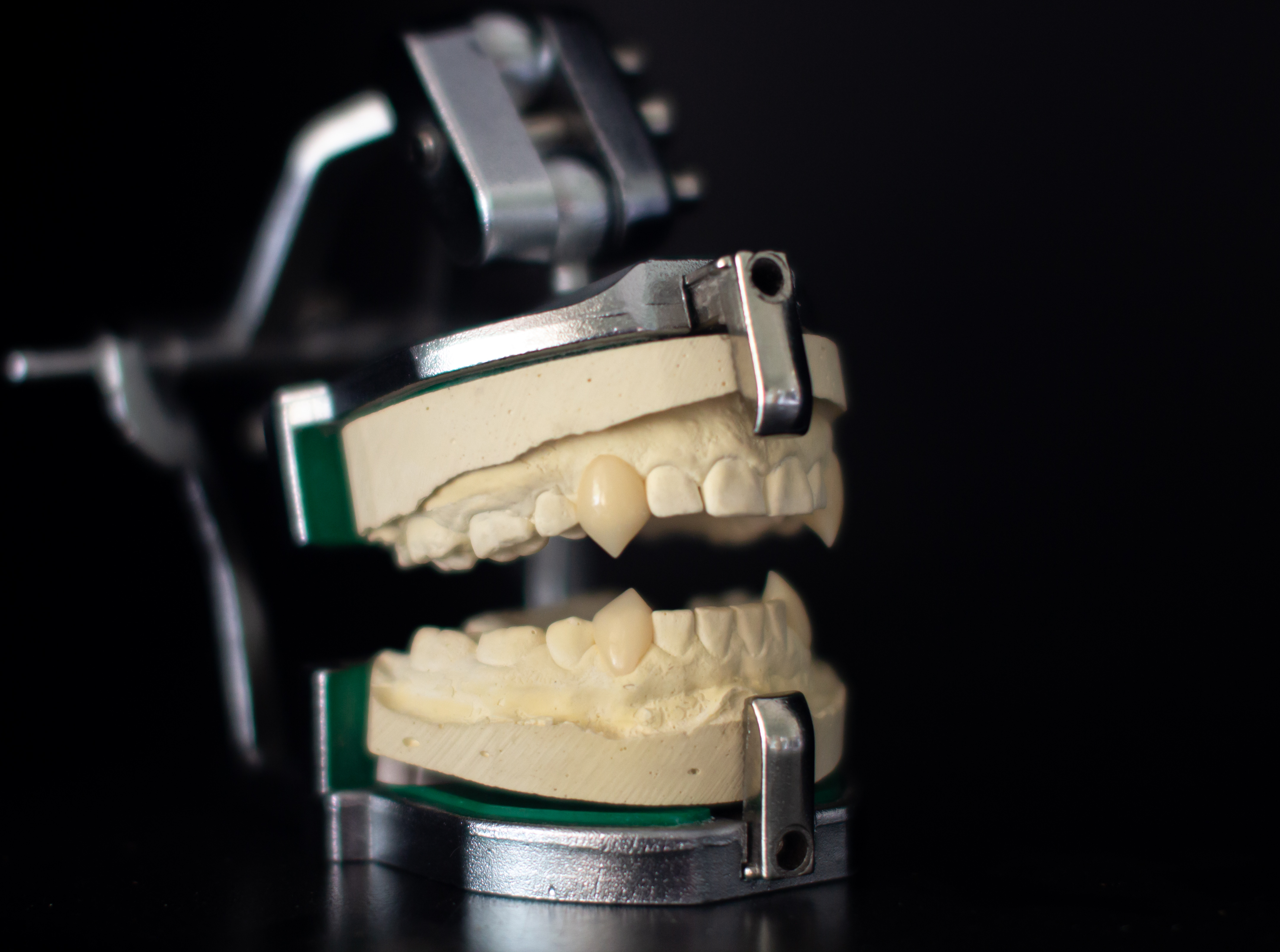 FangSmith | Custom Vampire Fangs | Fang Designs