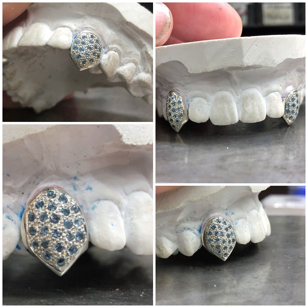 FangSmith | Custom Vampire Fangs | Fang Designs
