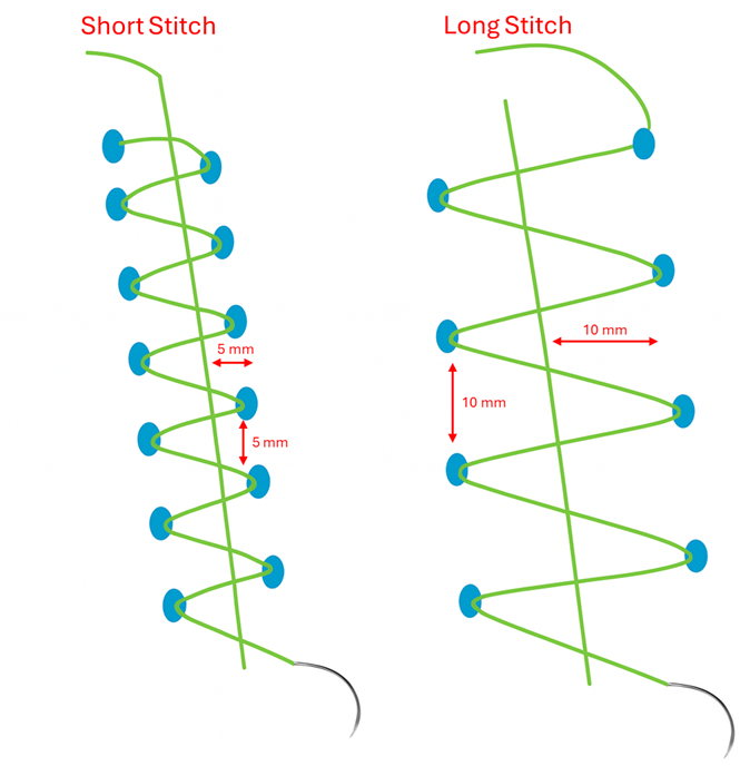 5-year clinical outcome of the ESTOIH trial comparing the short-bite ...