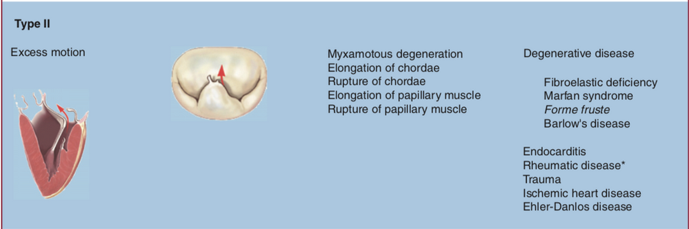 Qual a importância da classificação de Carpentier na cirurgia da valva ...