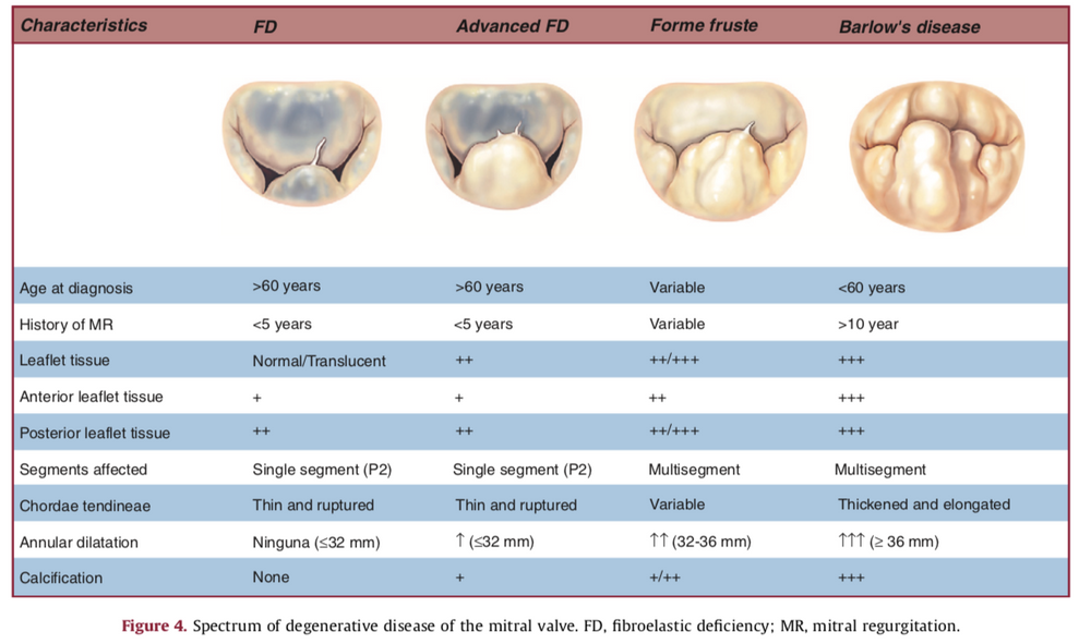 Qual a importância da classificação de Carpentier na cirurgia da valva ...