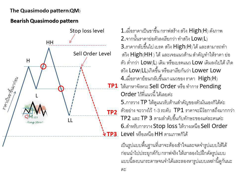 Quasimodo pattern (QM)