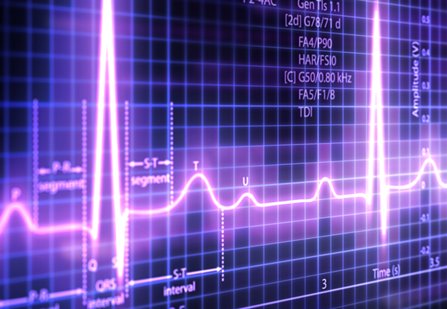 100 Years Ago: The innovation that Defined Cardiology