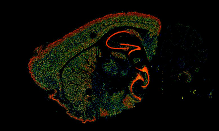 GRIN2A and GRIN2B Impacts on Neurological Development and Learning