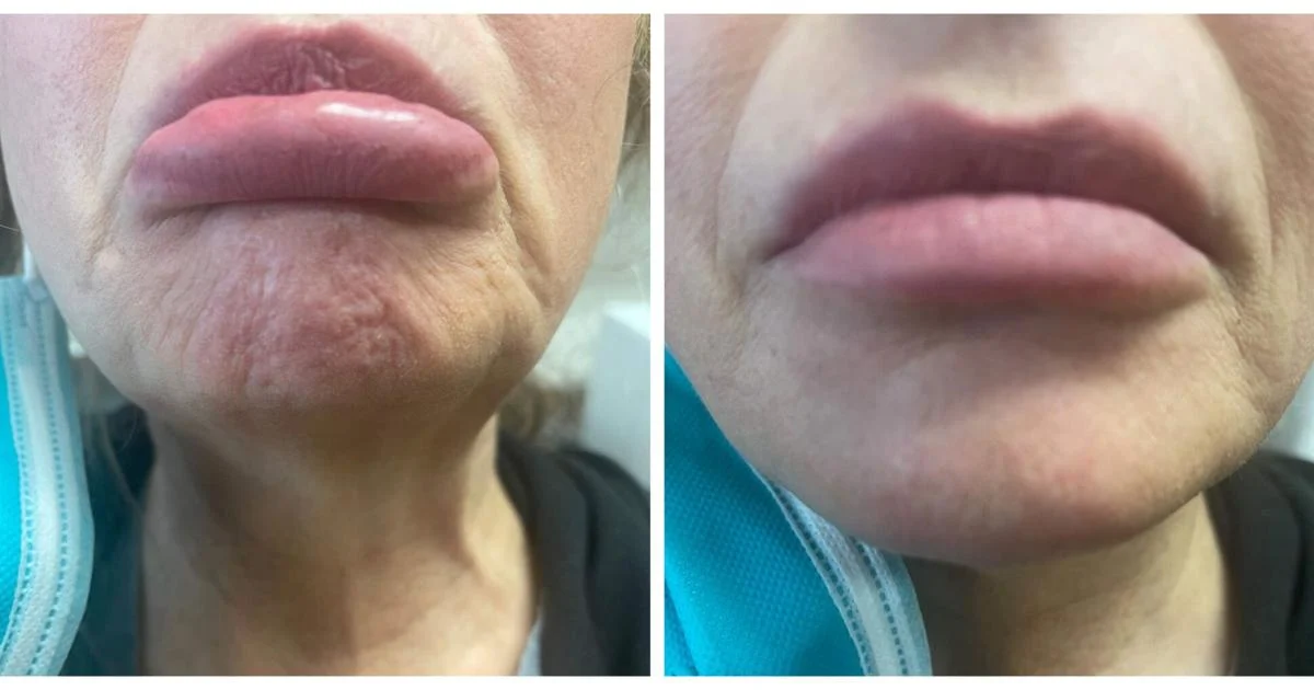 Book Online | Elevate Hydration