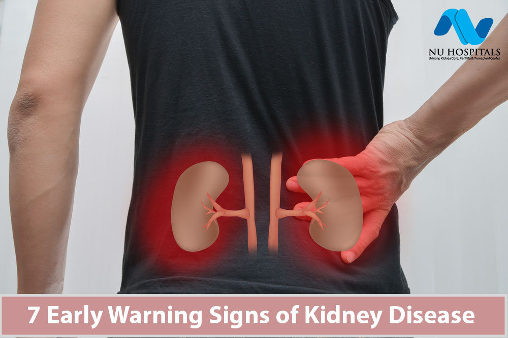 7 Early Warning Signs of Kidney Disease