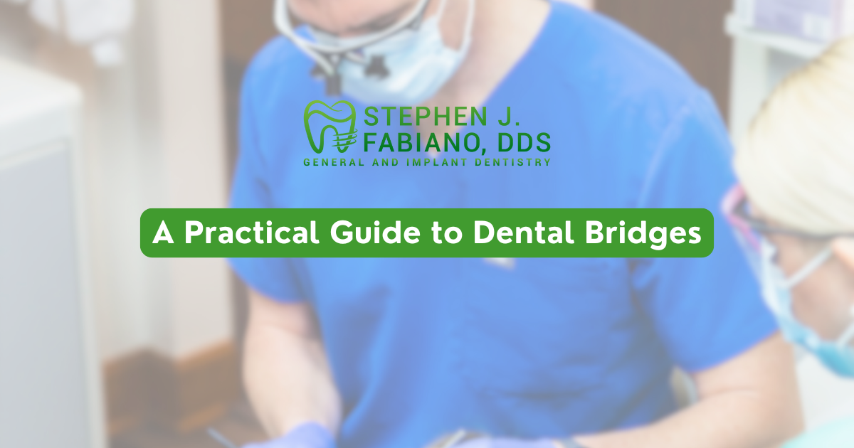A Practical Guide to Dental Bridges
