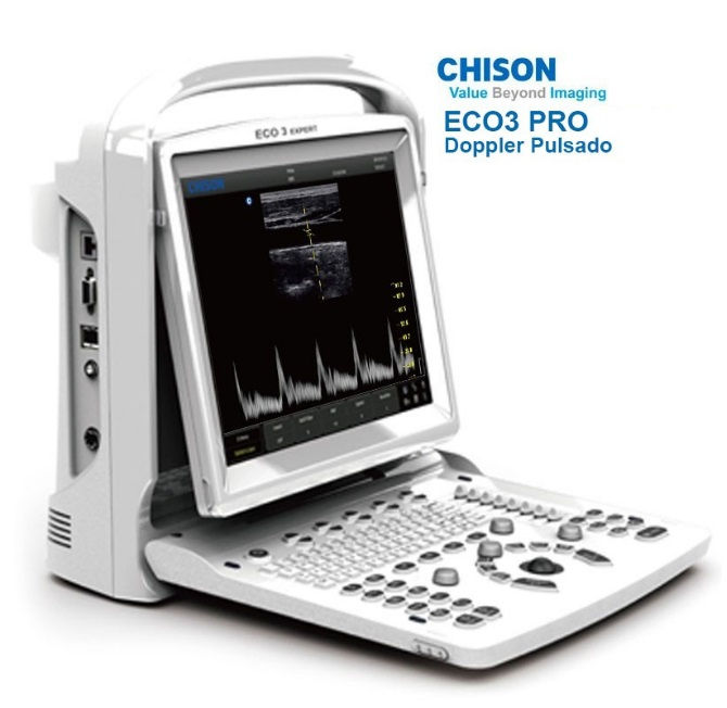 Ultrasonido Chison ECO3 Pro con transductor convexo | IMEDIQ